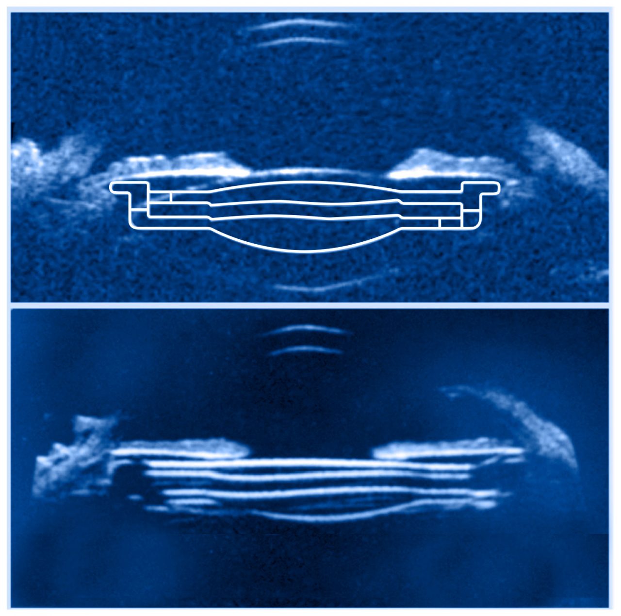 Technology | Akkolens